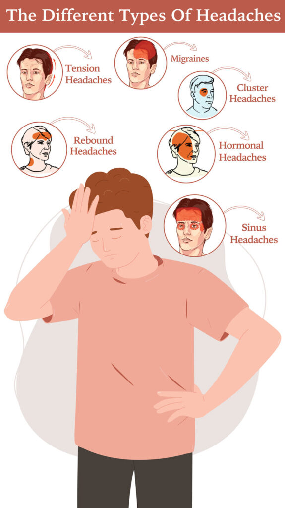 Understanding The Different Types Of Headaches Kane Hall Barry Neurology