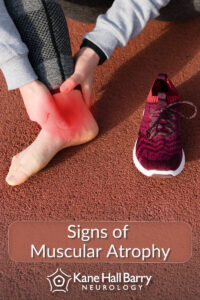 Atrophy - Kane Hall Barry Neurology